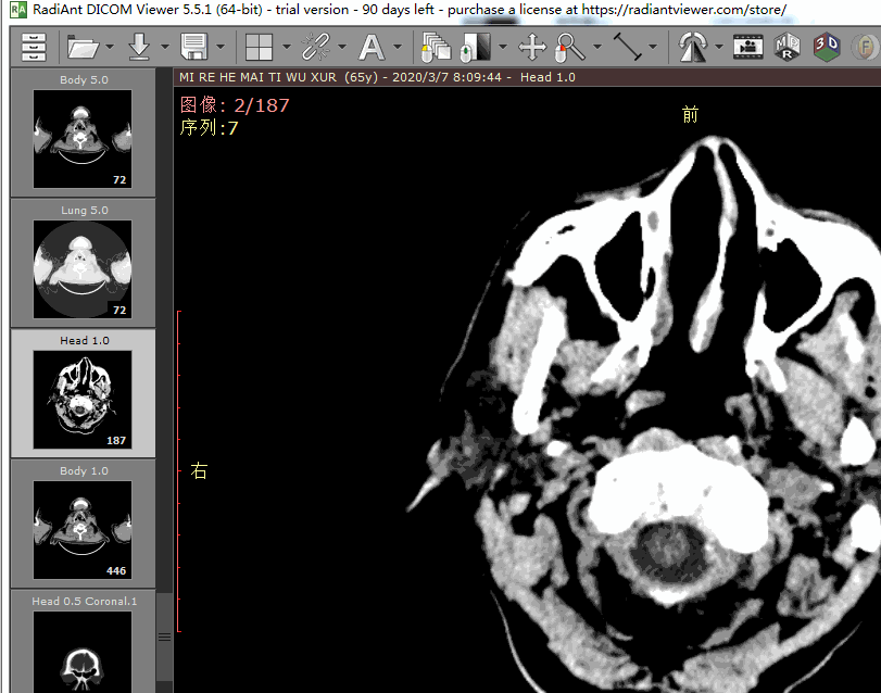 dicom文件信息修改_一款DIcom浏览器（一）-CSDN博客