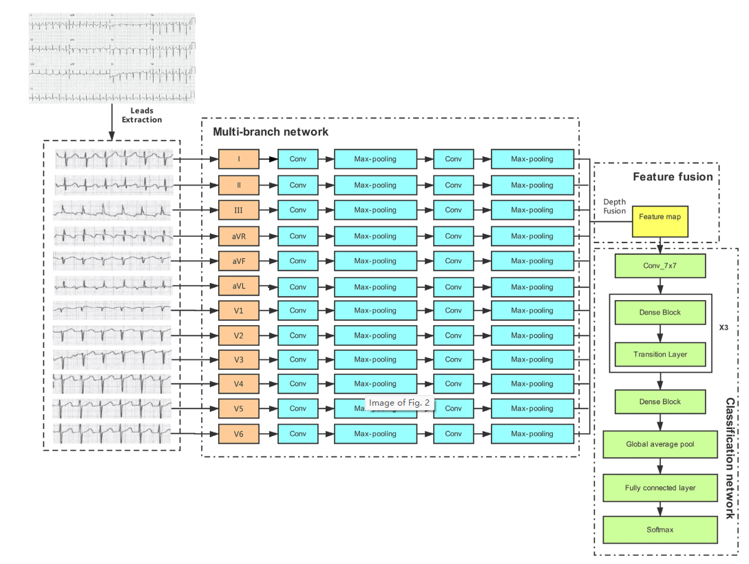 多分支融合网络用于12导联ECG图像心肌梗死筛查_针对心梗的ecg识别竞赛-CSDN博客