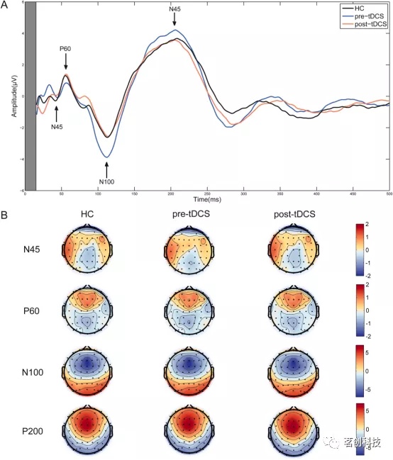 新文联播第8期 | tDCS可改善强迫症症状，调节皮层抑制_tdcs功能思维导图-CSDN博客