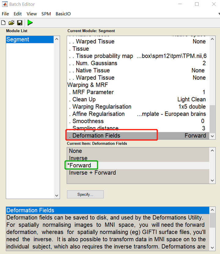SPM数据预处理【“傻瓜”操作版】-CSDN博客