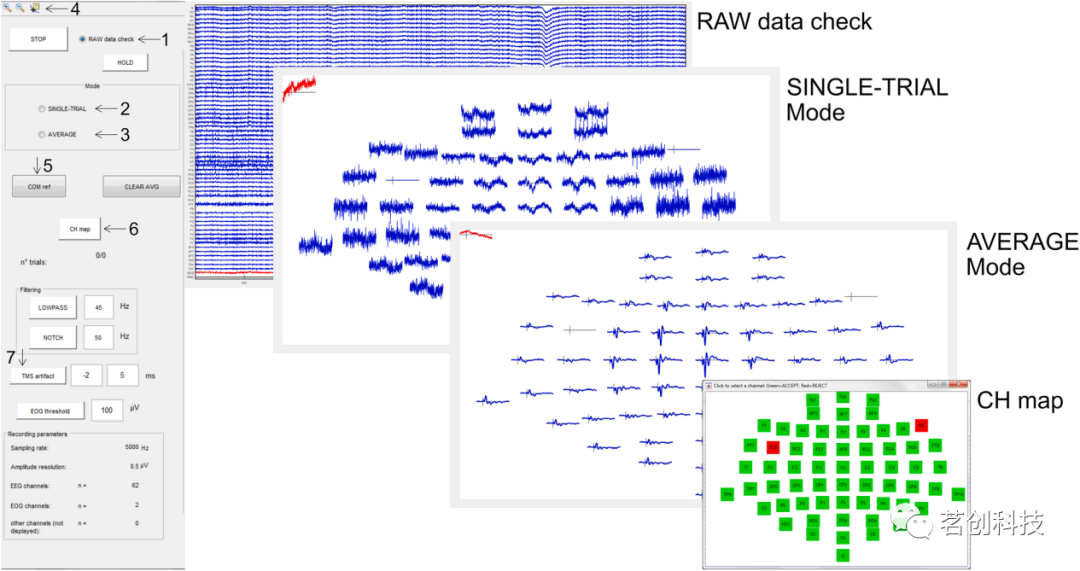 rt-TEP工具：实时显示TMS诱发电位，最大化皮层激活和最小化伪影_肌电诱发 tep-CSDN博客