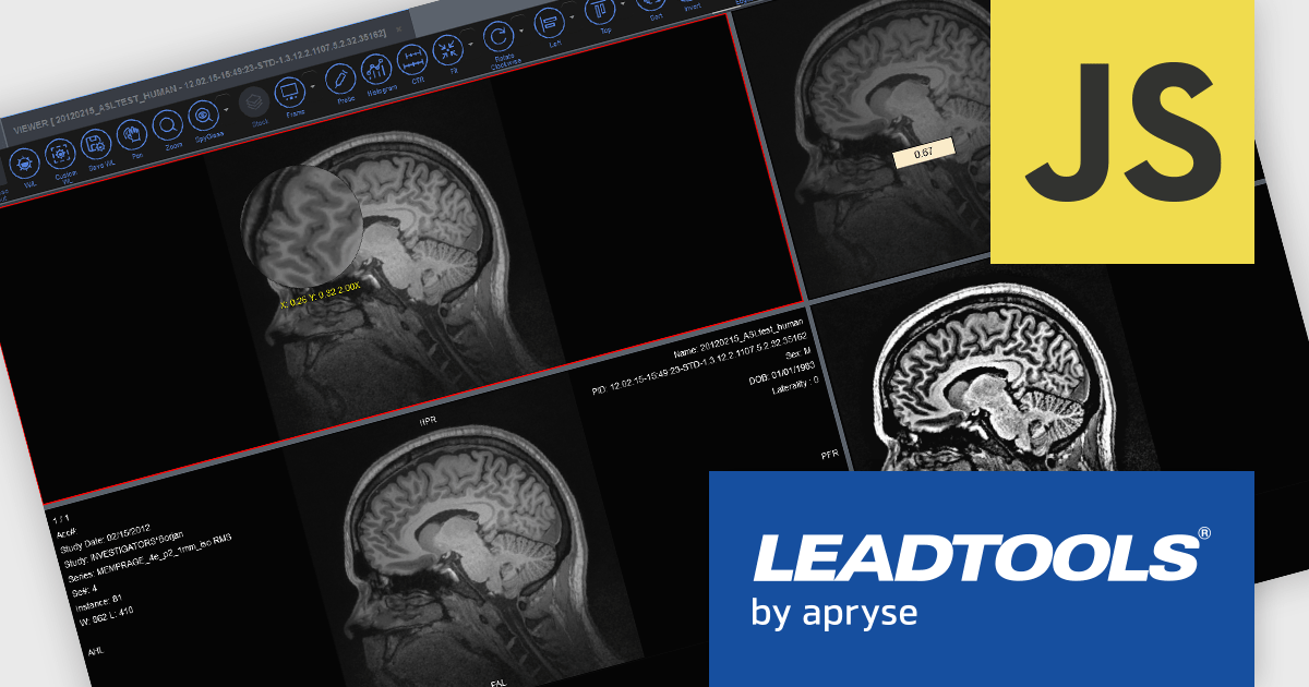 使用3D体积渲染查看 DICOM 图像-LEADTOOLS 23.0_dicom 3d-CSDN博客