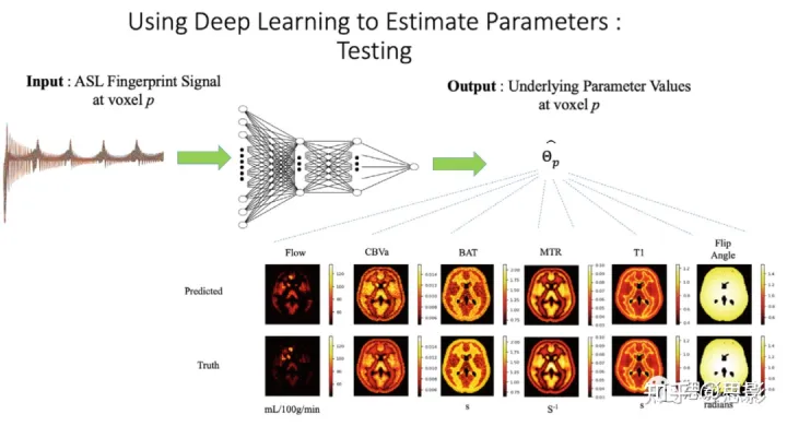 ASL 的最新技术发展：对最新技术的回顾_asl-mr att-CSDN博客