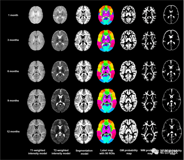 婴儿大脑MRI图谱集_mri image dataset for brain-CSDN博客