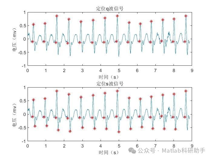 【心电信号】基于小波变换实现心电信号ECG QRS波检测，根据阈值定位R波信号附Mtalab代码-CSDN博客