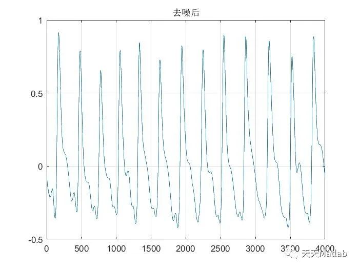 【信号去噪】基于小波变换实现脉搏信号去噪附Matlab代码_daubechies小波函数 (dbn)去噪-CSDN博客