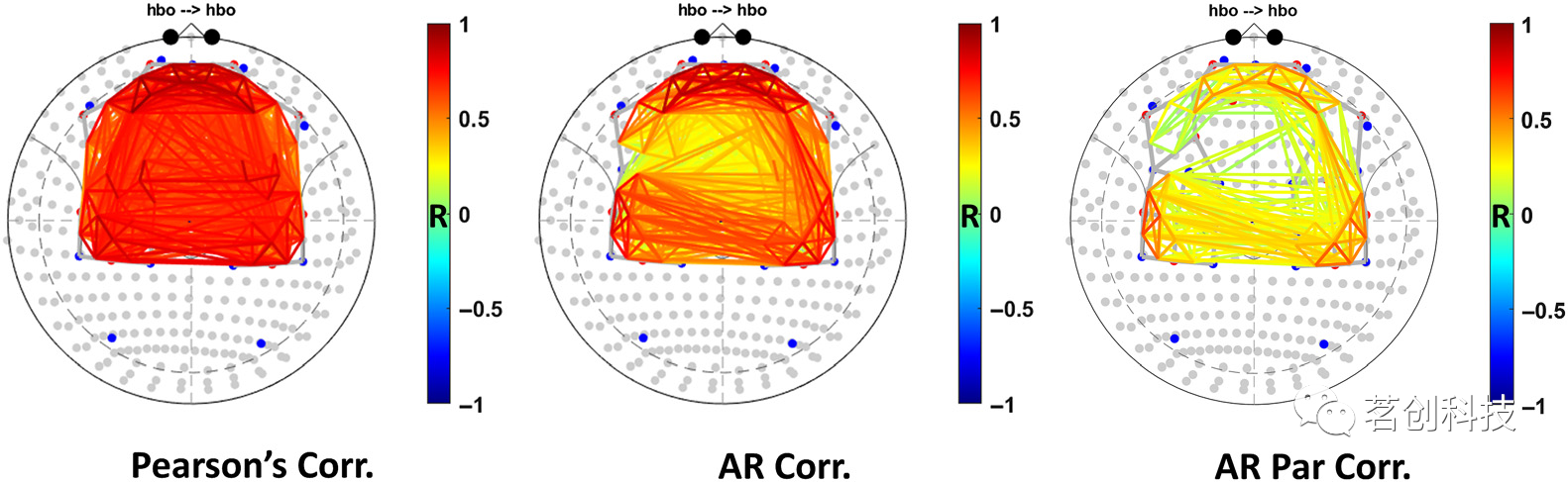 静息态fNIRS中的全局生理信号校正_cwt因果关系-CSDN博客