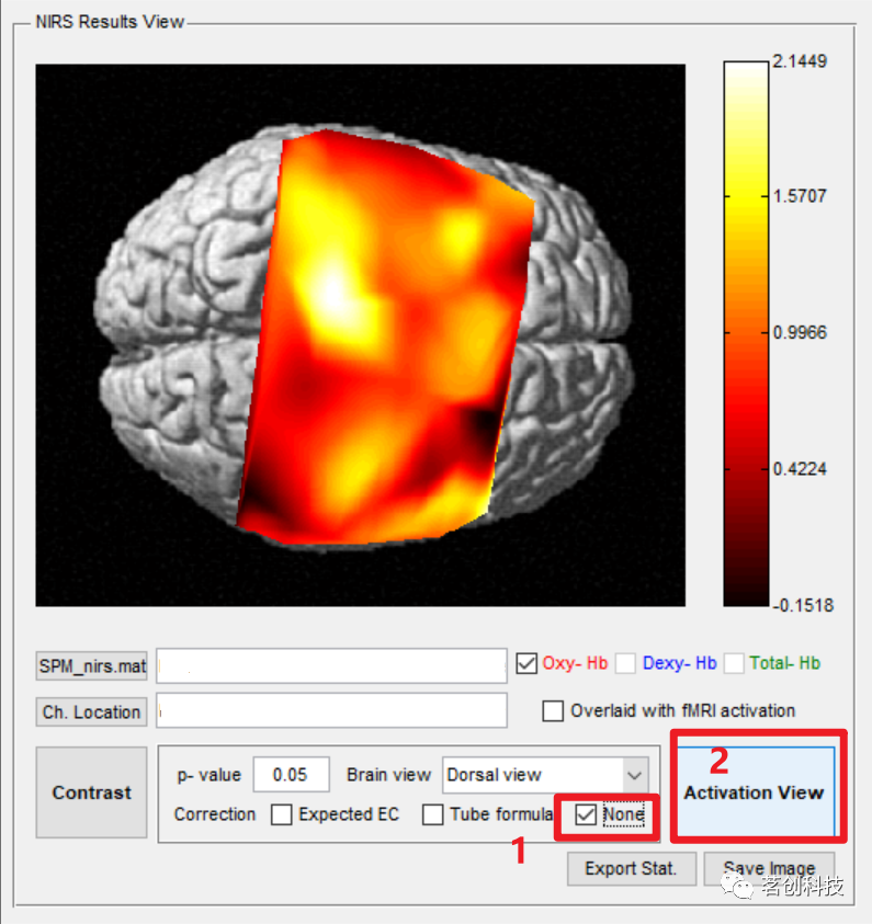 近红外干货 | NIRS_SPM单被试激活分析过程_nirs-spm-CSDN博客