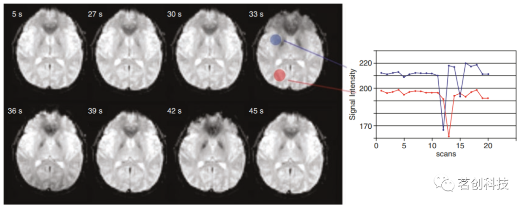 BOLD fMRI和DTI：伪影、技巧和诀窍_fmri图像处理后有残影怎么办-CSDN博客