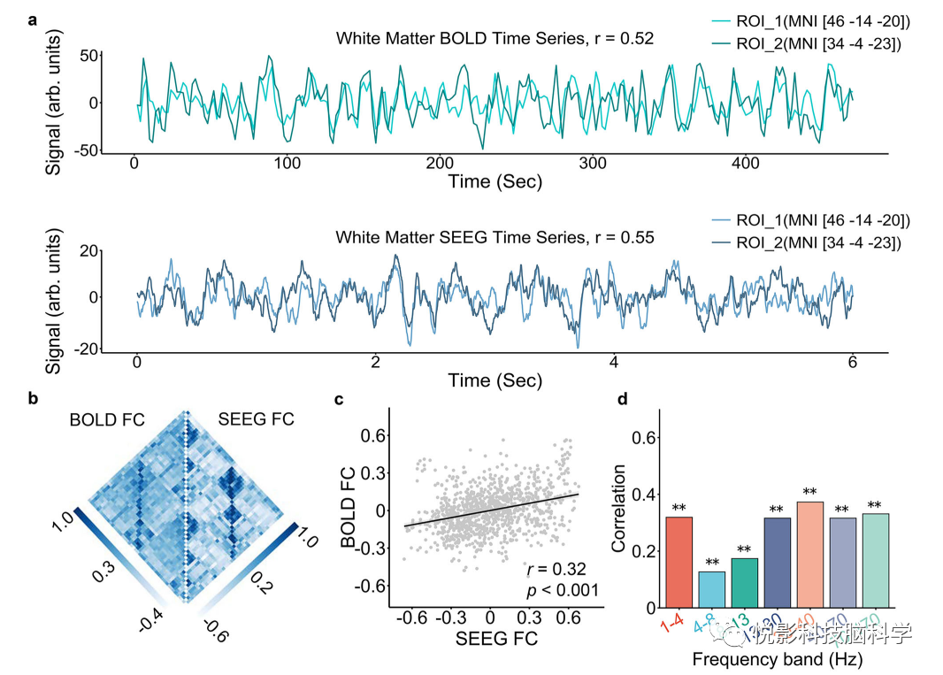 NC：脑白质BOLD功能连通性的颅内电生理及结构基础_大脑bold-CSDN博客