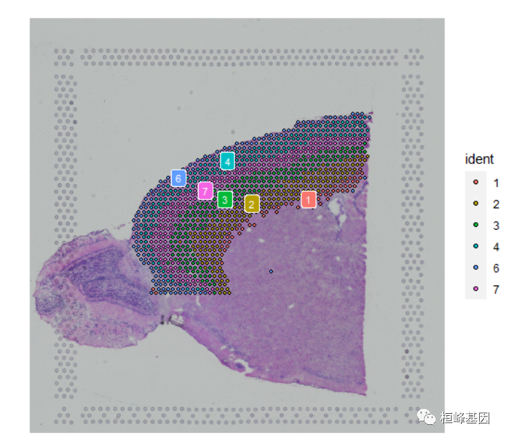 SCS【21】单细胞空间转录组可视化 (Seurat V5)-CSDN博客