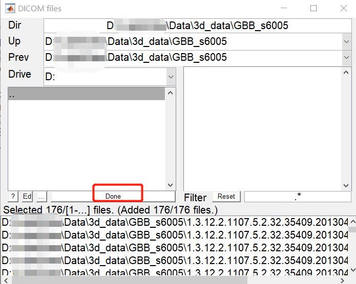 SPM数据预处理【“傻瓜”操作版】-CSDN博客