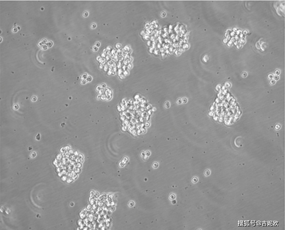 Raji细胞 P1-Raji细胞 Burkitt‘s人淋巴瘤细胞株_raji细胞侵染效率-CSDN博客