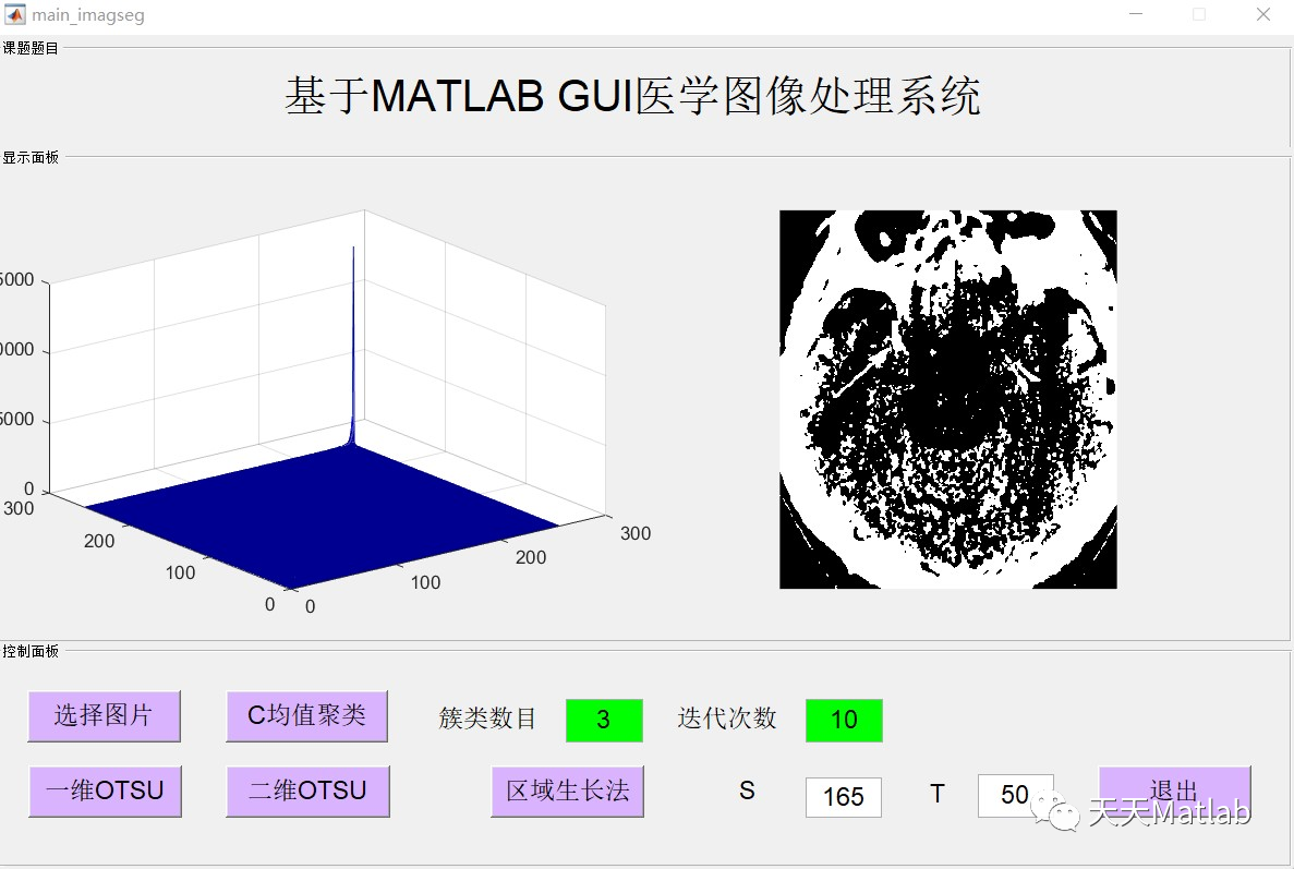 【图像分割】基于均值聚类+OUST+区域生长法实现MRI图像分割附matlab代码_基于深度学习分割医学影像matlab代码-CSDN博客