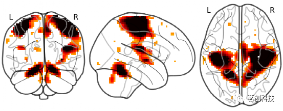 Nilearn：绘制大脑图像-CSDN博客