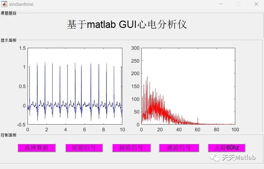 【心电信号】基于matlab实现心电信号分析_基于matlab的心电信号的分析与处理设计-CSDN博客