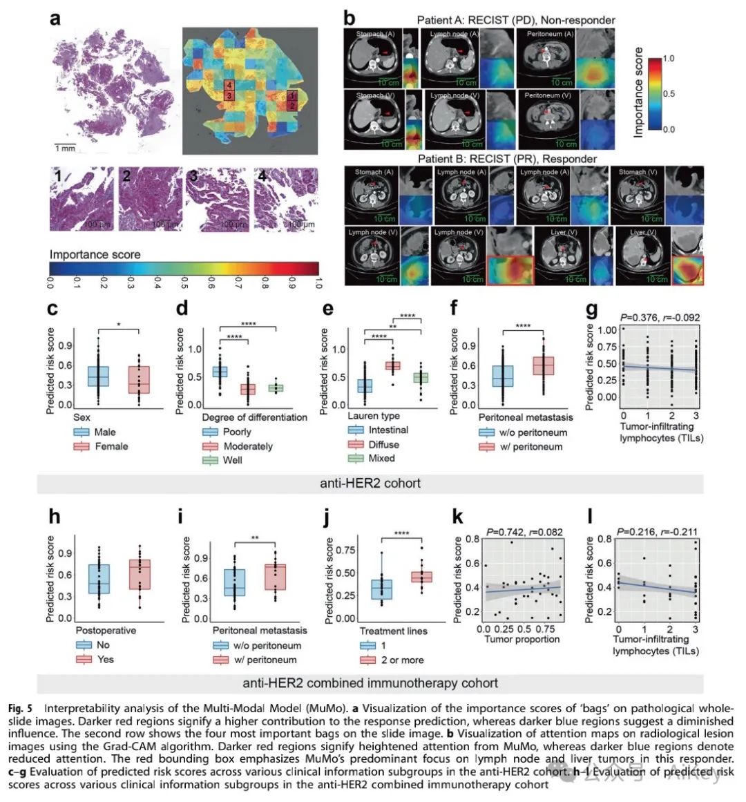 IF=40.8,基于多模态模型预测癌症抗HER2治疗或抗HER2联合免疫疗法的反应_predicting gastric cancer response to anti-her2 th-CSDN博客