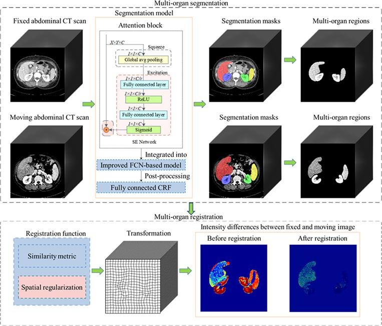 医学图像配准论文学习——基于深度学习的分割方法对腹部CT进行高效的两步多器官配准（2021）；基于深度学习的检测在腹部CT图像上靶器官非刚性配准（2021）；_深度学习的肝脏ct图有几个通道数 ...