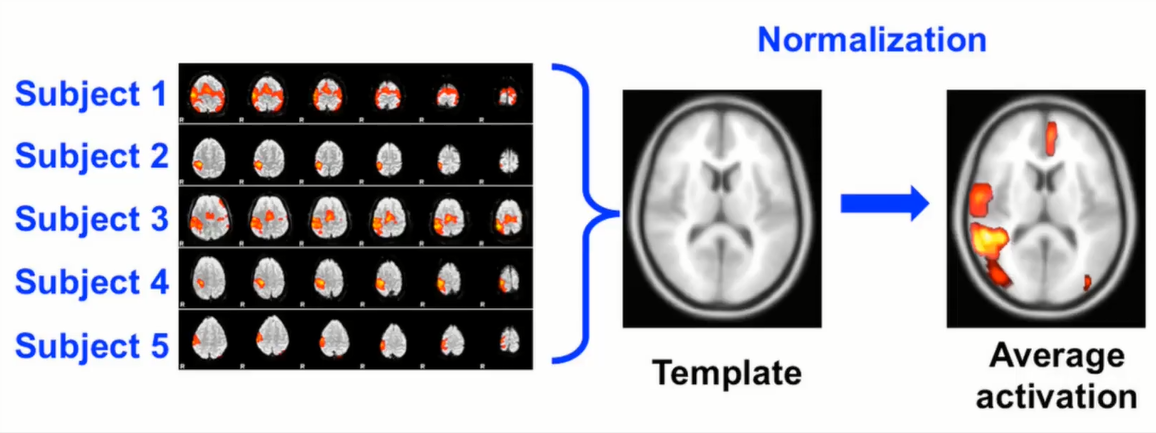利用fsl进行配准_fsl对均值图像进行线性配准-CSDN博客