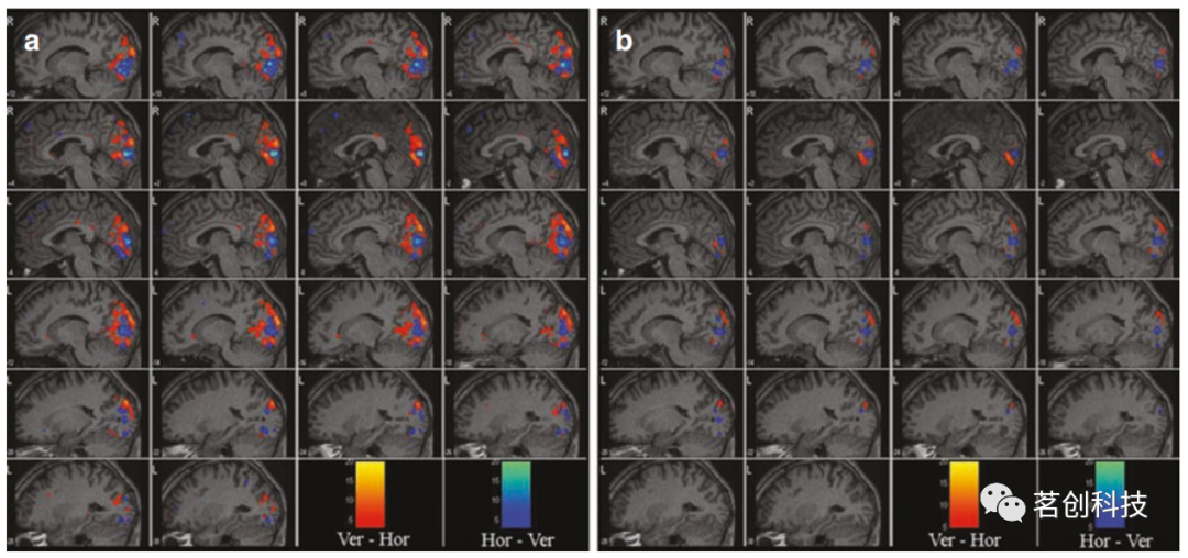BOLD fMRI和DTI：伪影、技巧和诀窍_fmri图像处理后有残影怎么办-CSDN博客