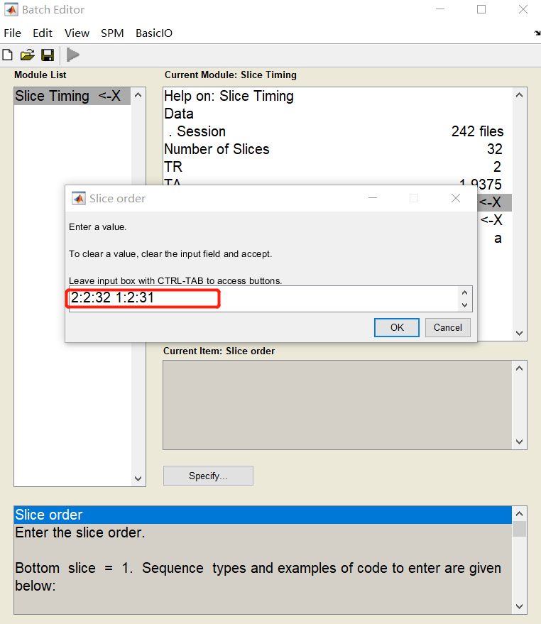 SPM数据预处理【“傻瓜”操作版】-CSDN博客