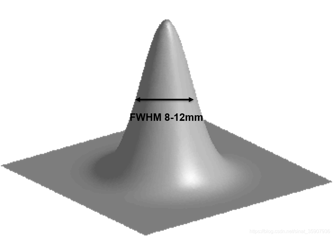 vbm 分析_MRI脑影像分析从哲学到技术：一文搞懂VBM预处理基本原理（全网最详细解析）..._weixin_39742392的博客-CSDN博客