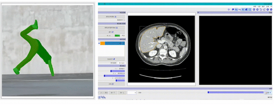 基于英特尔®OpenVINO玩转PaddleSeg图像分割！_medicalsegv2-CSDN博客