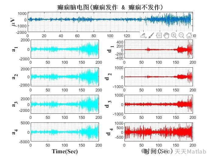 【癫痫检测】基于小波分析EEG实现癫痫发作信号检测附Matlab代码_eeg matlab topomap-CSDN博客