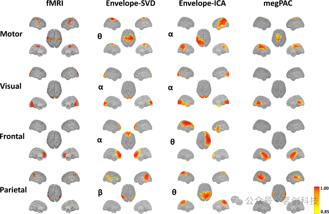 利用数据驱动的MEG分析方法提取fMRI静息态网络-CSDN博客