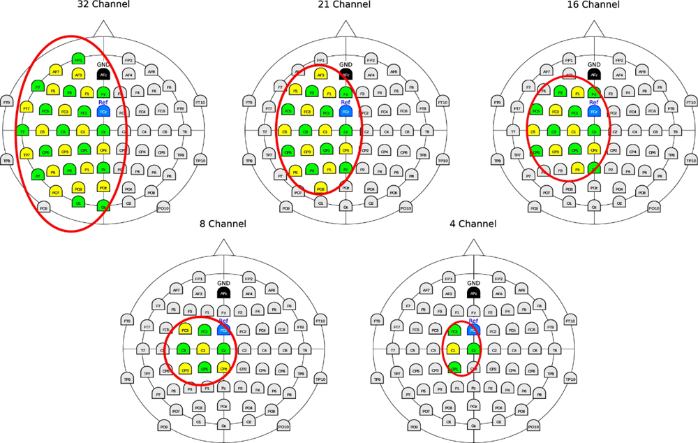 通过EEG数据的迁移学习让运动意图识别的校准过程加速-CSDN博客