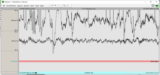 edfread matlab,Sleep-EDF Database Expanded 读取-CSDN博客
