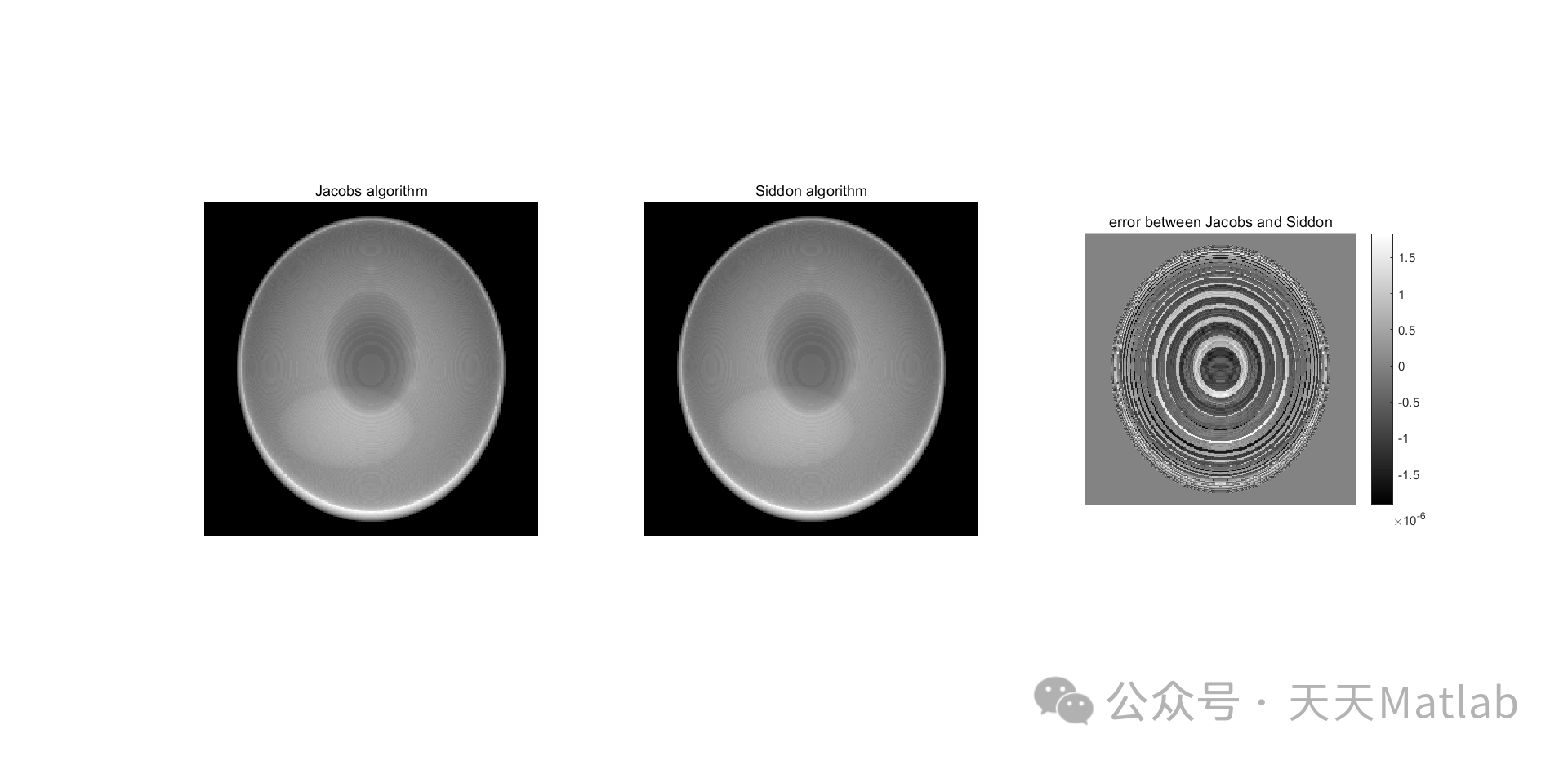 【成像】基于Siddon 算法和 Jacobs 算法对锥束 CT 进行正向投影计算附matlab代码-CSDN博客