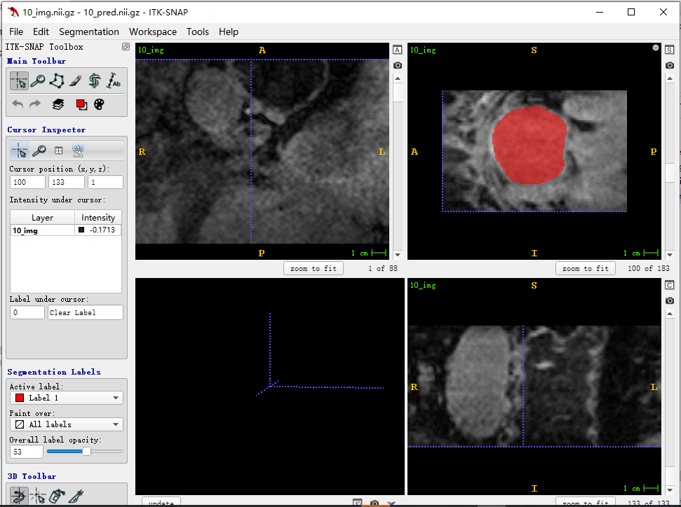 ITK-SNAP基础教程_itk snap-CSDN博客