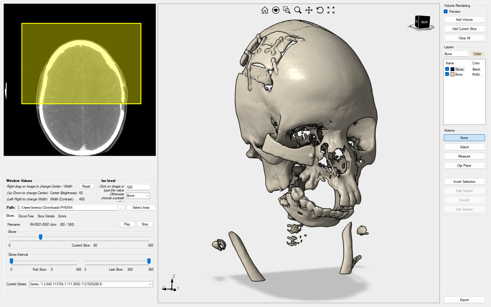 Devdept Eyeshot -热门实例参考_eyeshot demo示例-CSDN博客
