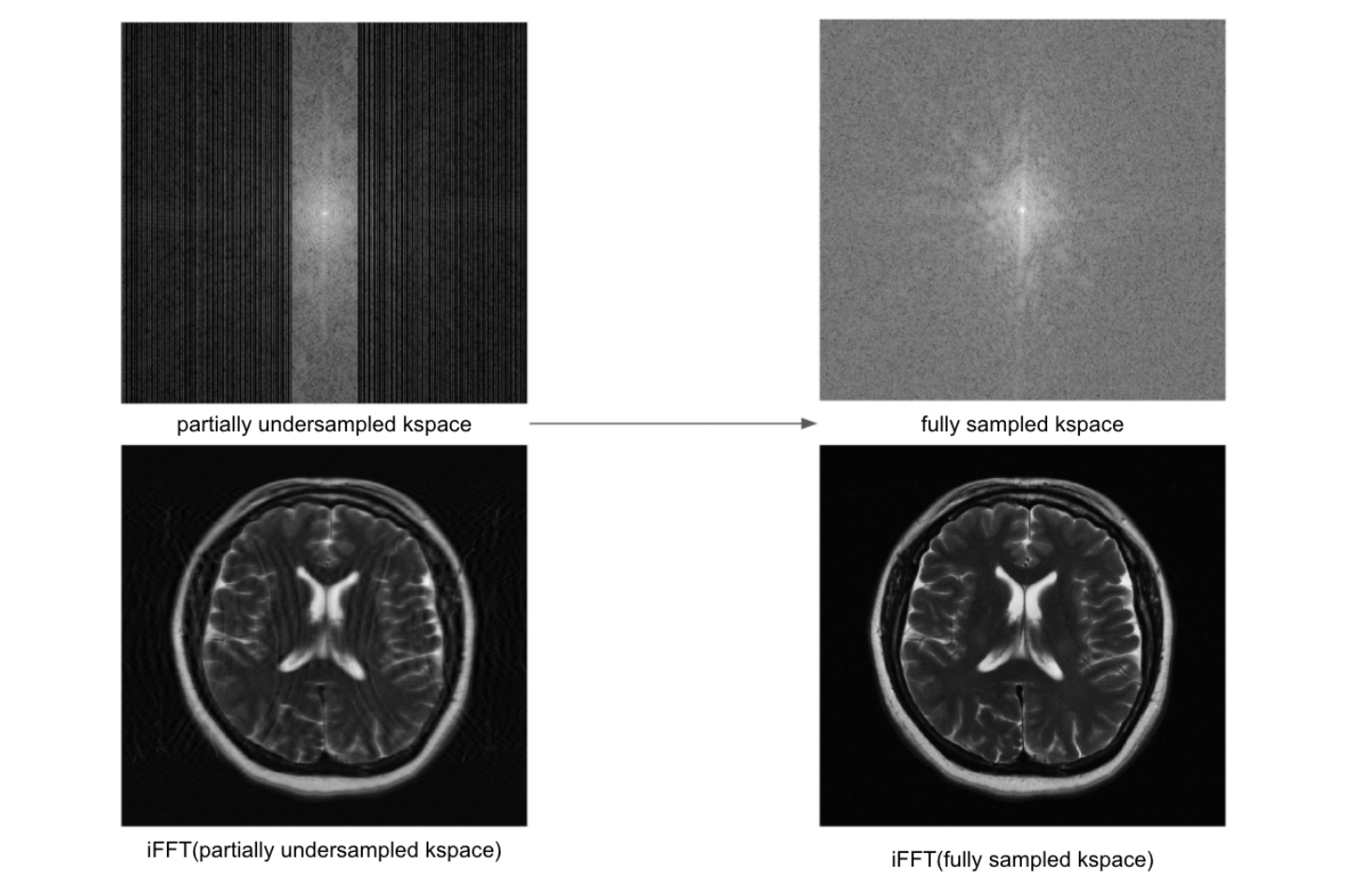 【持续更新】Awesome Accelerated-MRI-Reconstruction-Papers_an eigenvalue ...