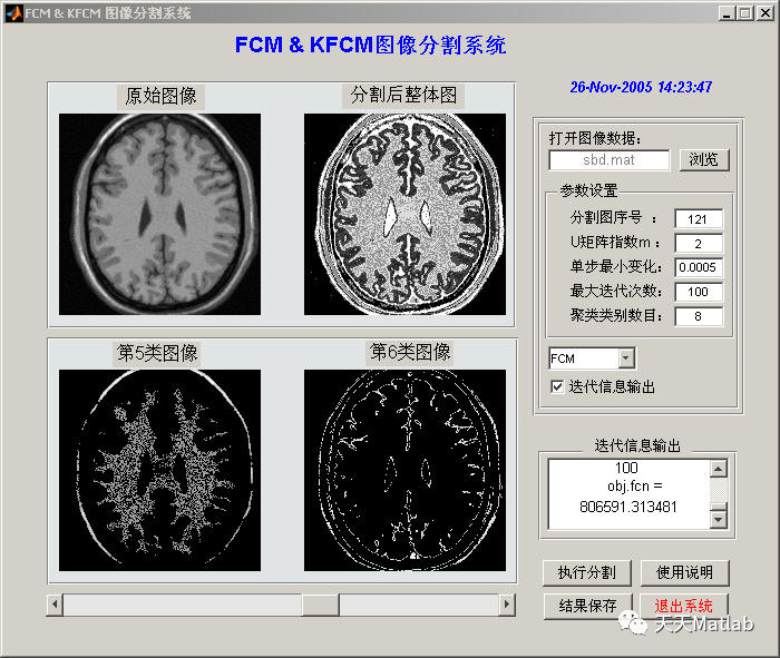 【图像分割】基于KFCMC和FMC两种聚类算法实现MRI图像的分割matlab代码_mri 图像空间标准化算法-CSDN博客