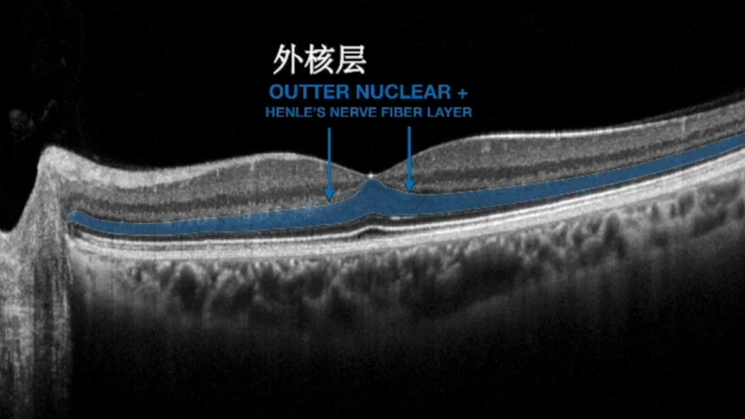 视网膜正常oct图_绝对干货视频第三弹正常OCT分层教你阅读-CSDN博客