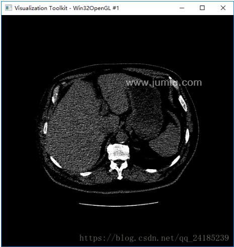 python vtk dicom_Python vtk读取并显示dicom文件示例-CSDN博客