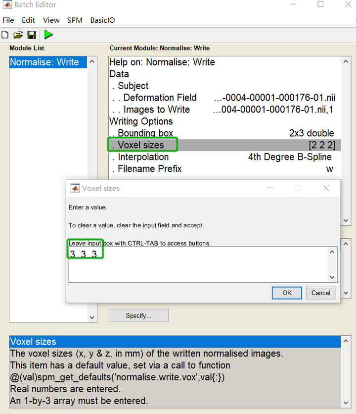 SPM数据预处理【“傻瓜”操作版】-CSDN博客