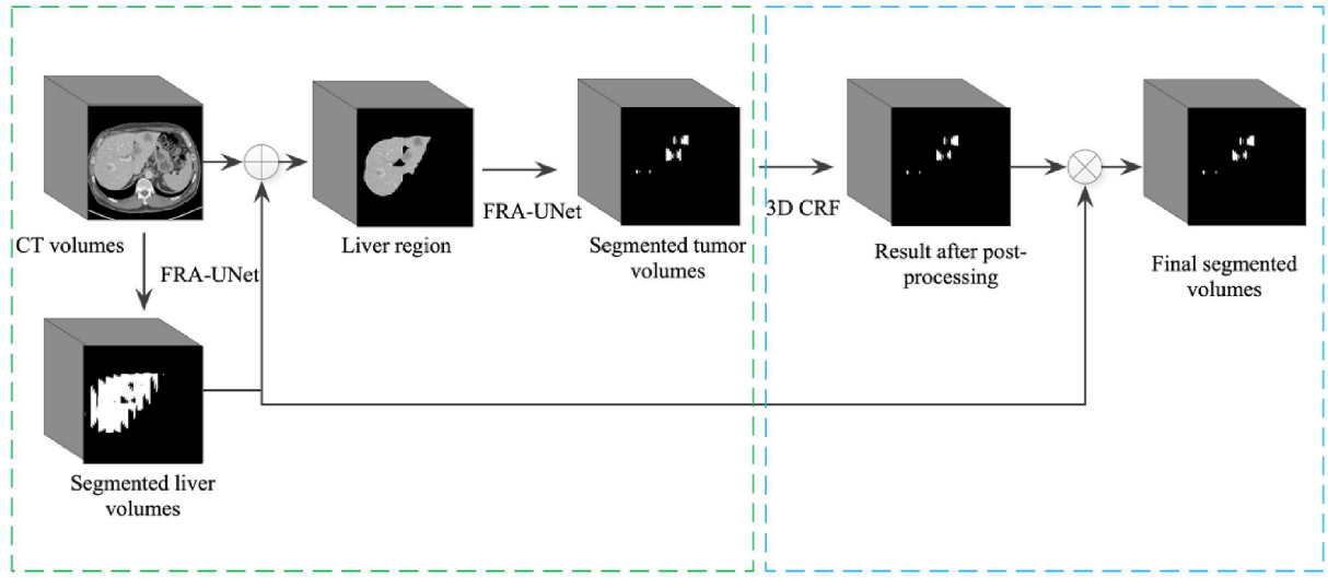 论文笔记Efficient two-step liver and tumour segmentation on abdominal CT_lits肝脏肿瘤相关论文-CSDN博客