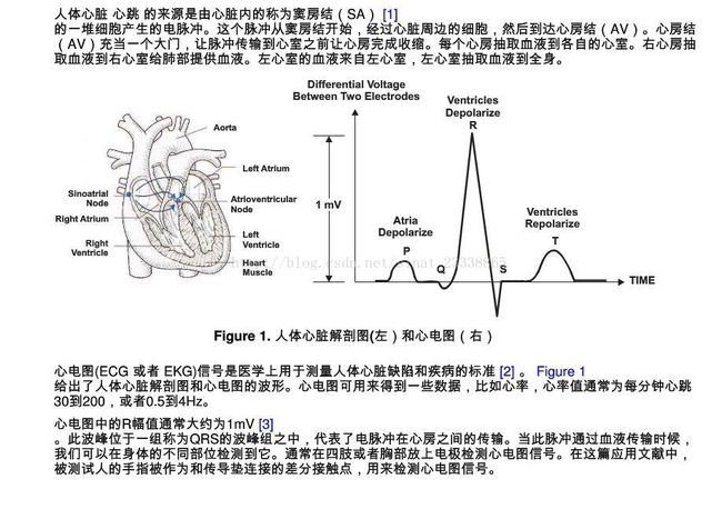 ecg去噪 matlab,基于matlab对ECG信号进行滤波处理-CSDN博客