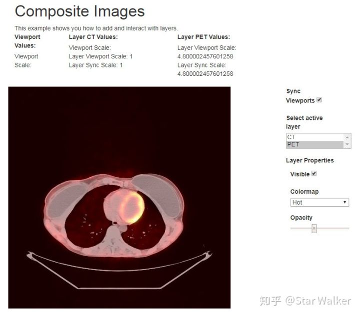 JS编写的医疗DICOM影像浏览工具_cornerstonejs怎么用-CSDN博客