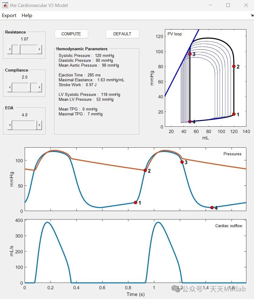 【心脏】基于matlab的I心脏和大动脉运动仿真-CSDN博客