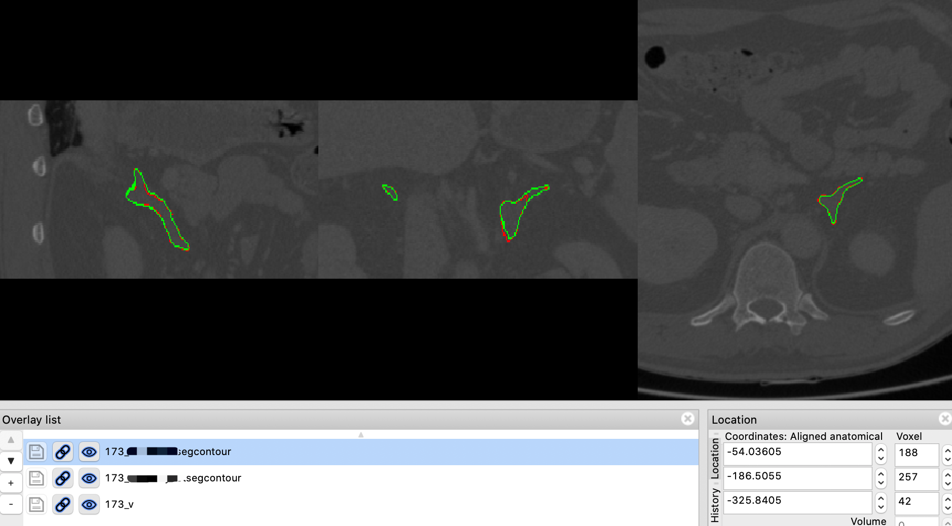 fsleyes -- 一款多功能影像数据查看器_fsleyes updating the texture data-CSDN博客