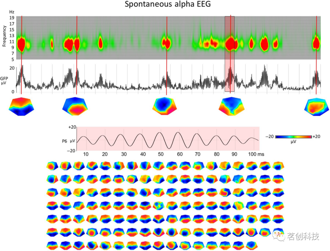 高分辨率EEG的空间分析-CSDN博客