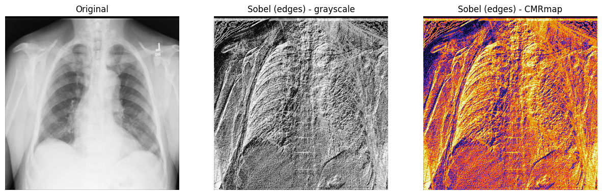 NumPy 应用：X射线图像处理_射线扫描里面的grayscale plot-CSDN博客
