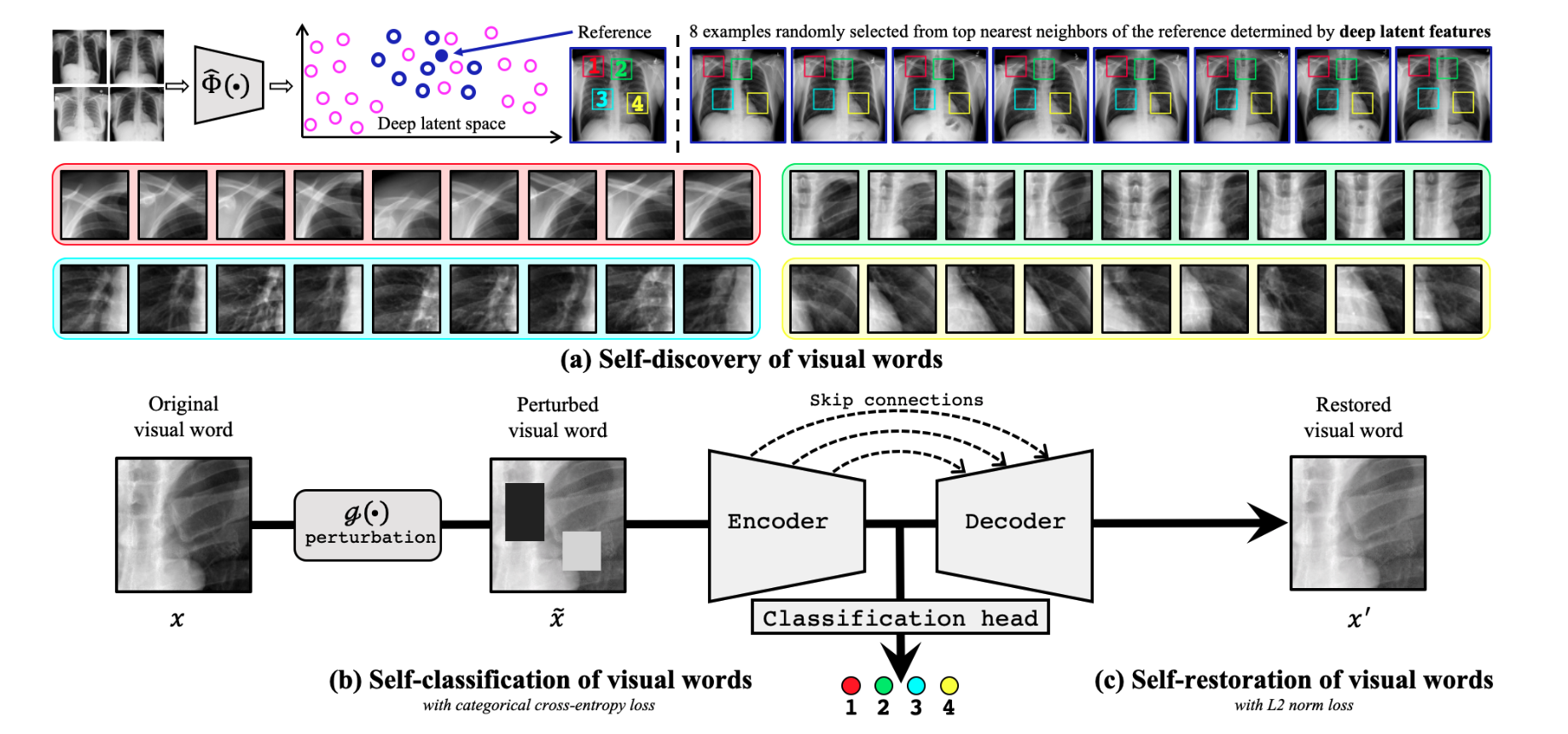 Transferable Visual Words: Exploiting the Semantics of Anatomical ...