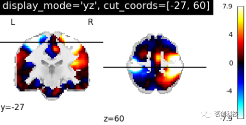 Nilearn：绘制大脑图像-CSDN博客