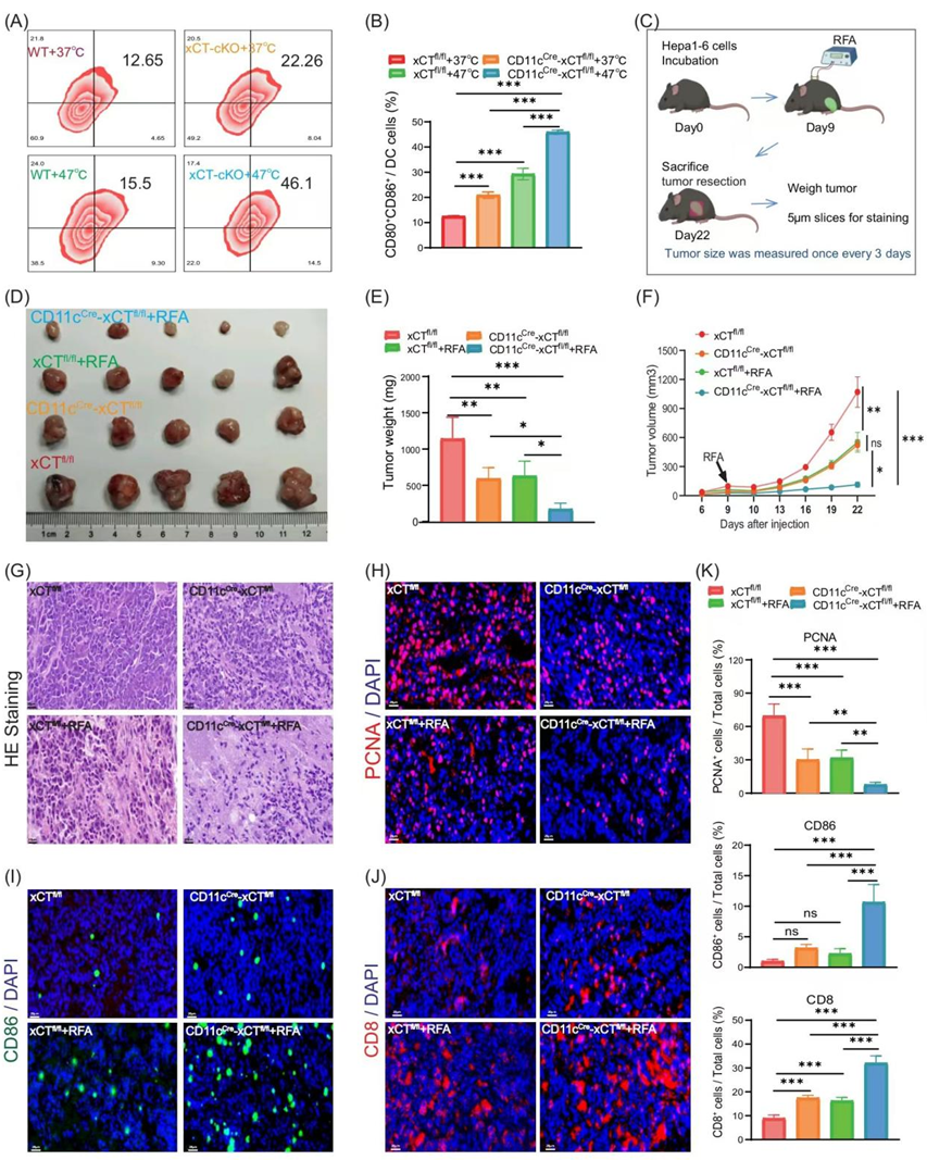 iMeta | 汤步富/罗鹏/黄昭-靶向SLC7A11增强肝细胞肝癌消融中的免疫反应-CSDN博客