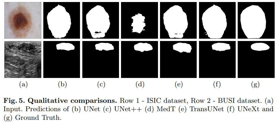 UNeXt：第一个基于卷积和MLP的快速医学图像分割网络-CSDN博客